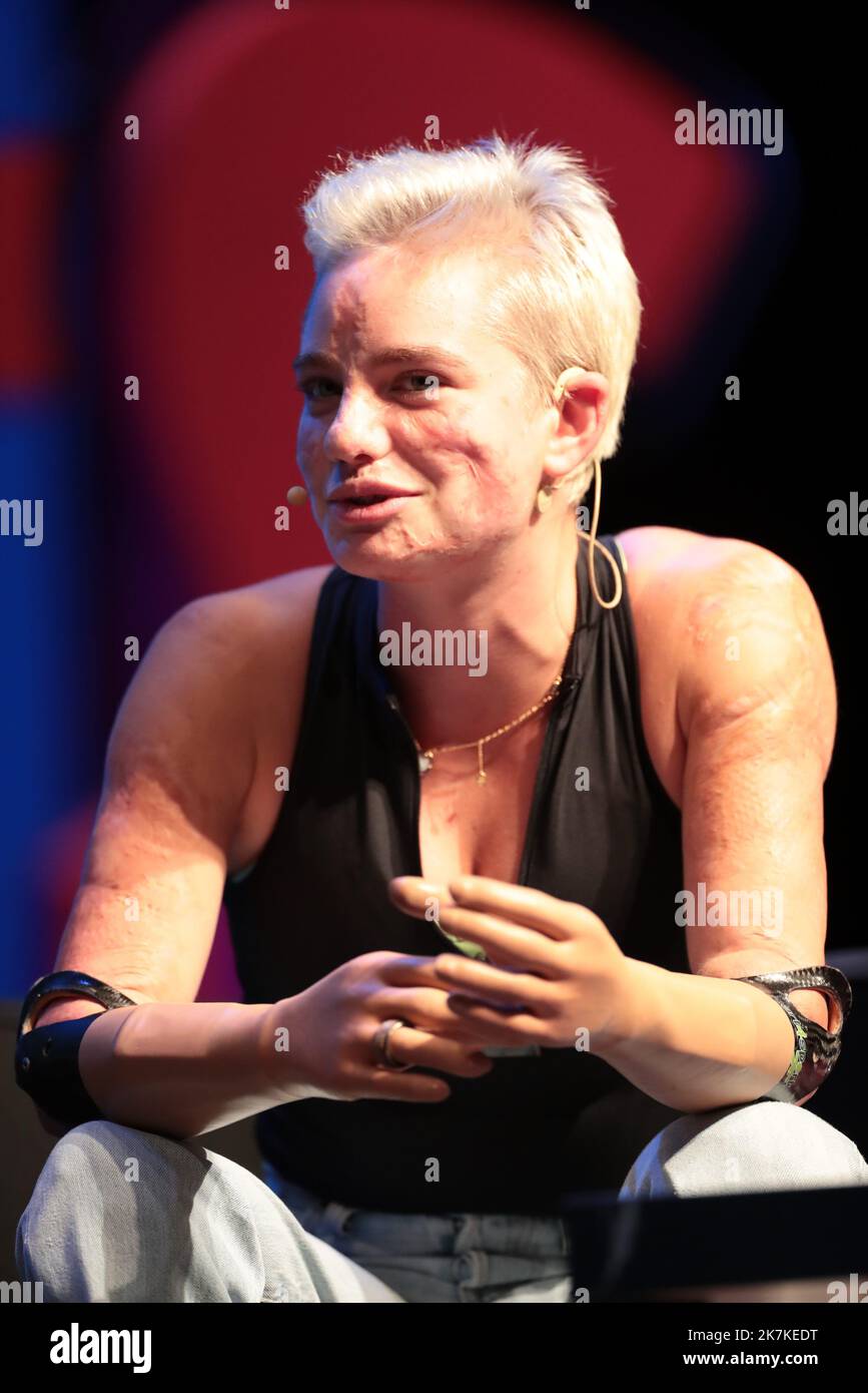 ©Pierre Teyssot/MAXPPP ; Bebe Vio in Trento, Italy on September 25 ...