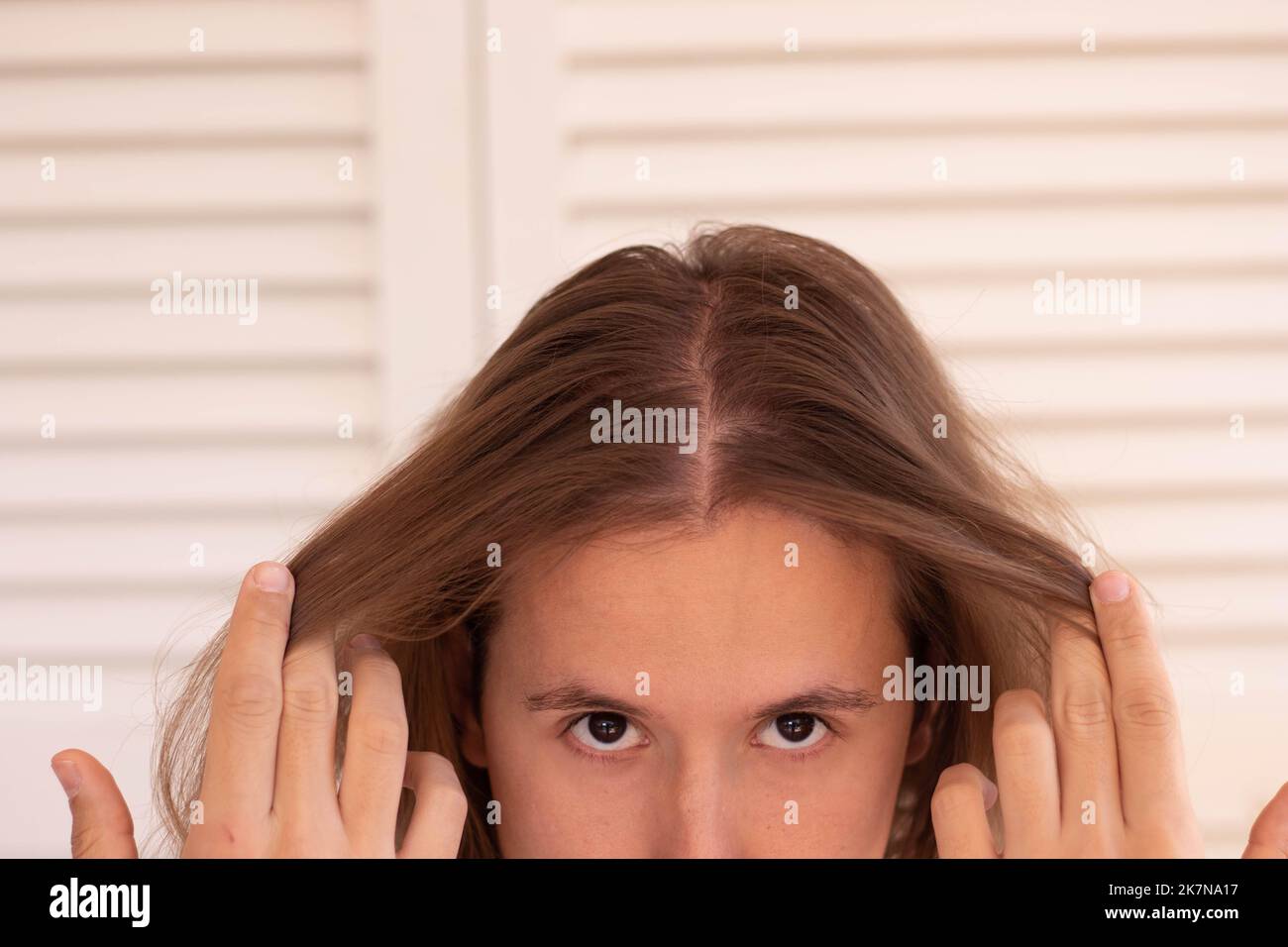 Close up view of young man with long hair showing his hair line with ...