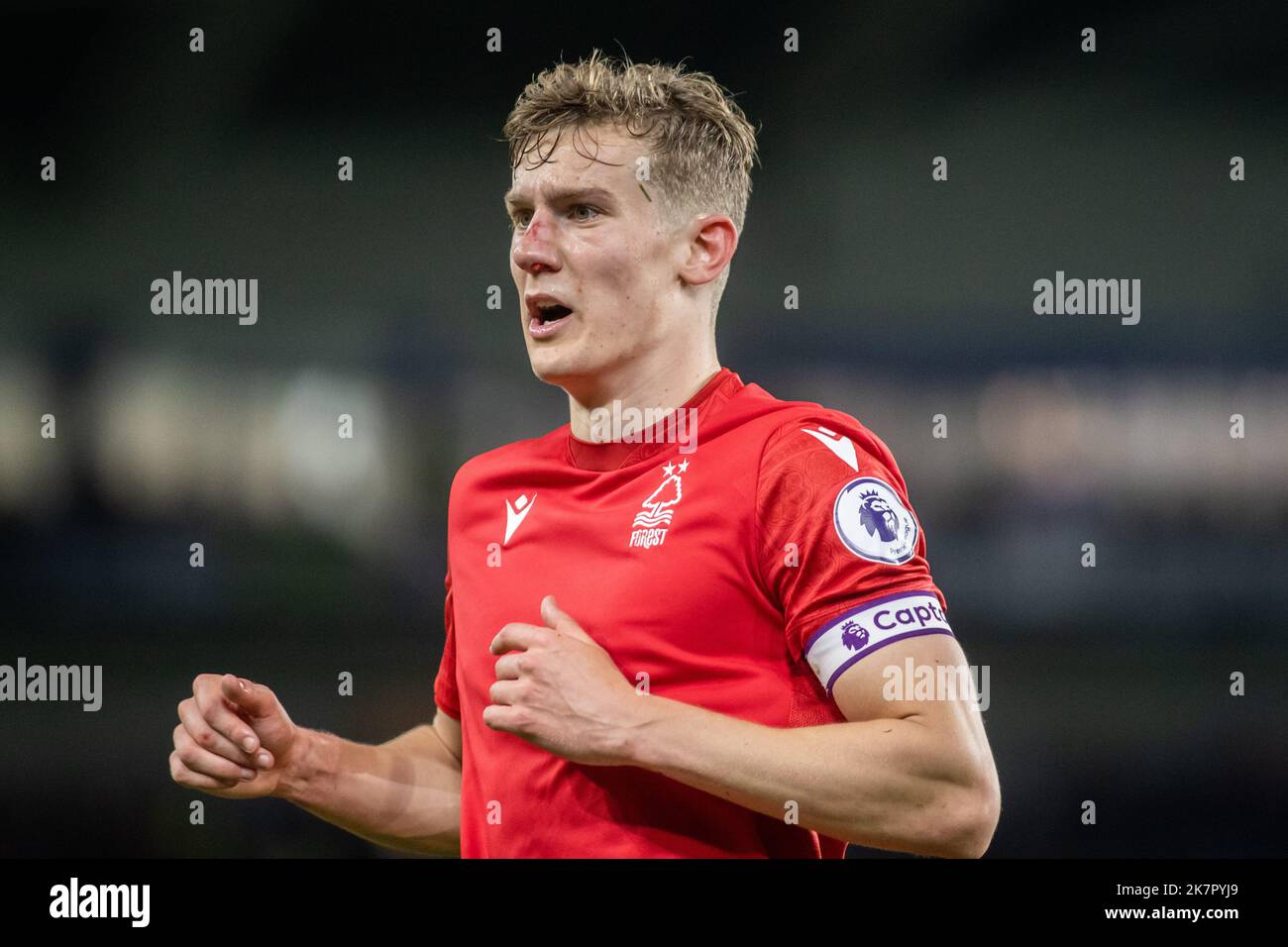 Ryan Yates #22 of Nottingham Forest battles on with a bloodied nose ...
