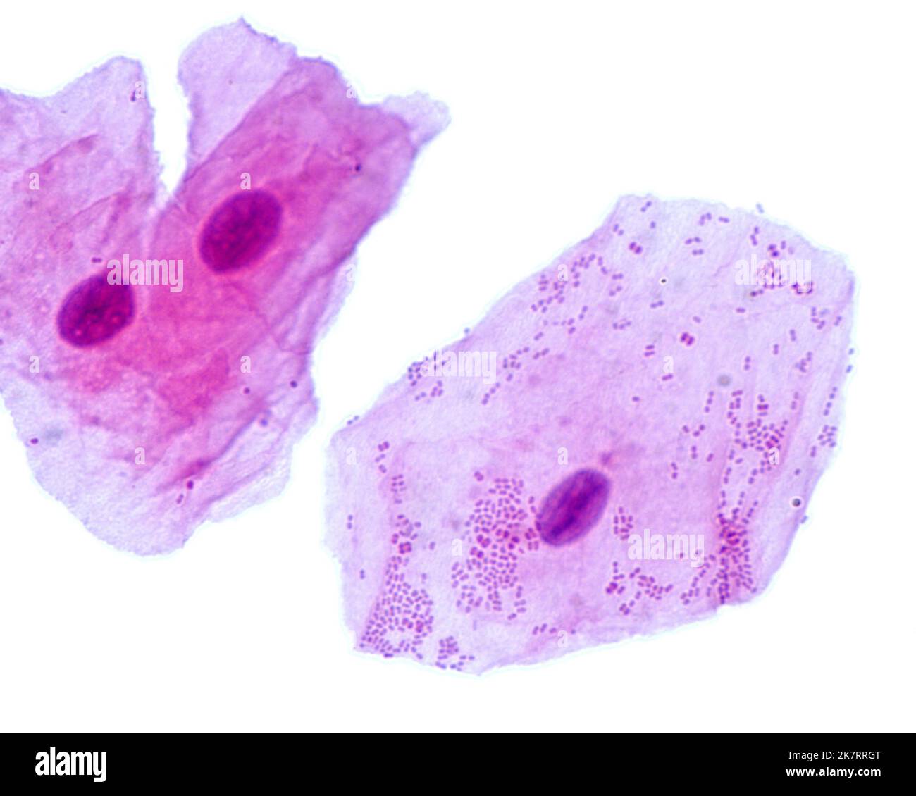 Light micrograph of a buccal smear showing desquamated squamous cells ...