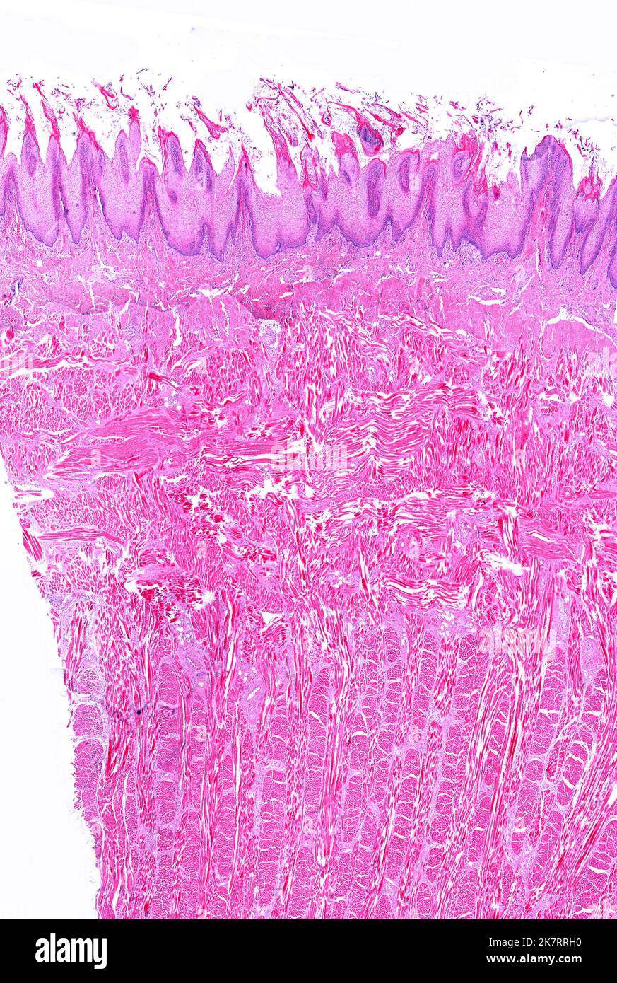 Light micrograph of the upper surface of a human tongue showing, from ...