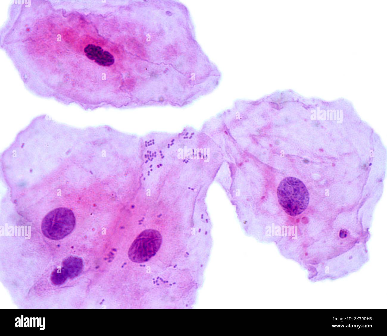 Light micrograph of a buccal smear showing desquamated squamous cells ...