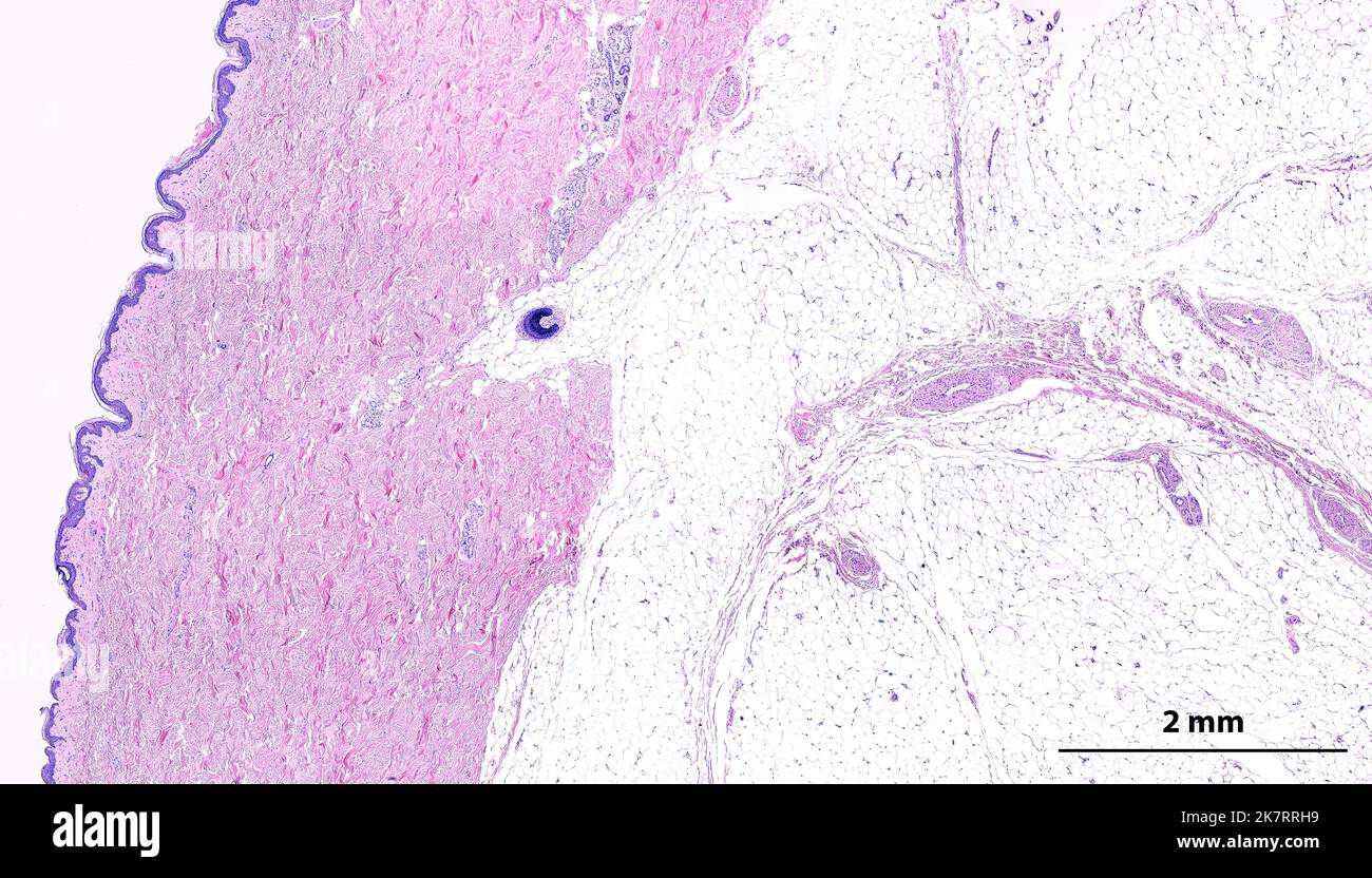 Light micrograph of thin skin showing form left to right, the epidermis ...
