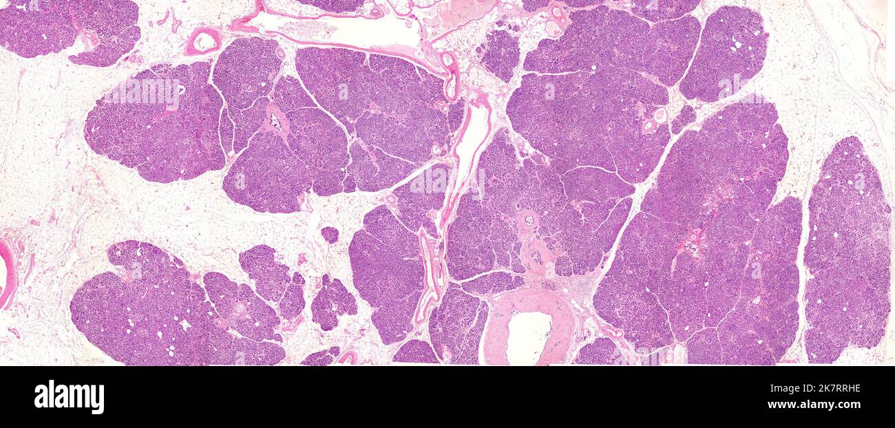 Light micrograph of a section through the human pancreas in the tail ...