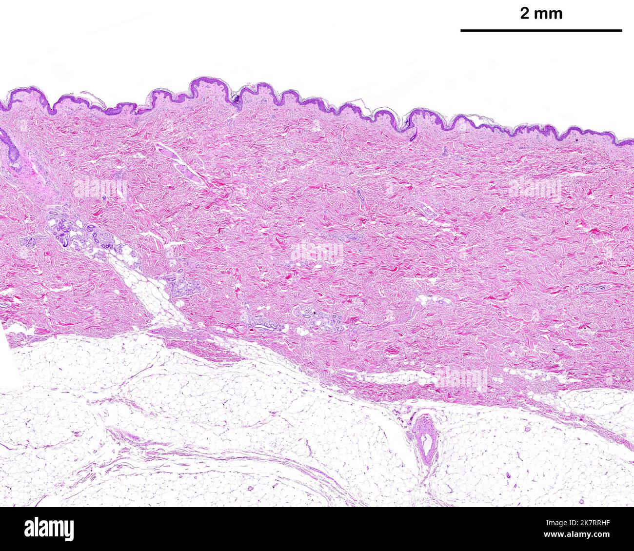 Light micrograph of thin skin showing from top to bottom, the epidermis ...