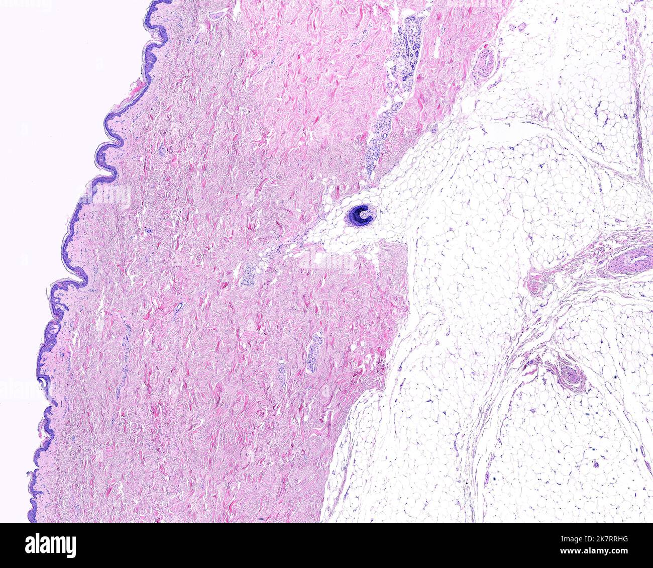 Light micrograph of thin skin showing form left to right, the epidermis ...