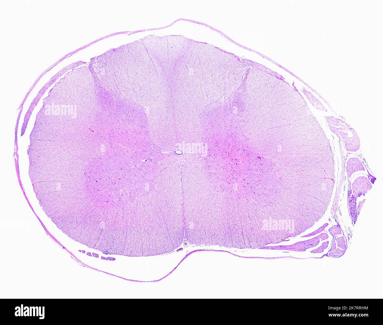 Light micrograph of a cross-sectioned human spinal cord at the cervical ...