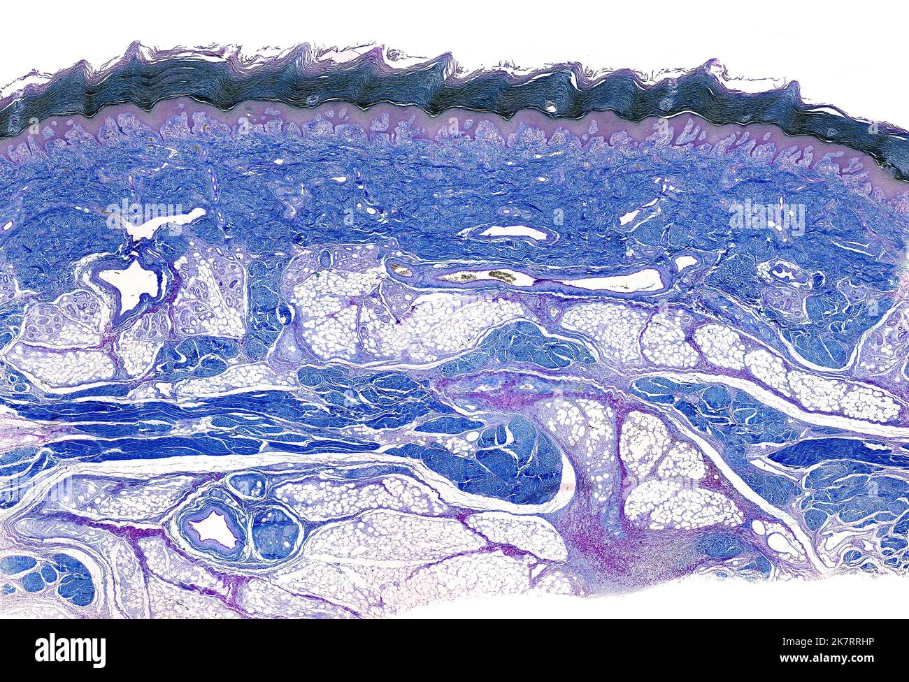 Light micrograph of human thick skin stained with the Cajal-Gallego ...