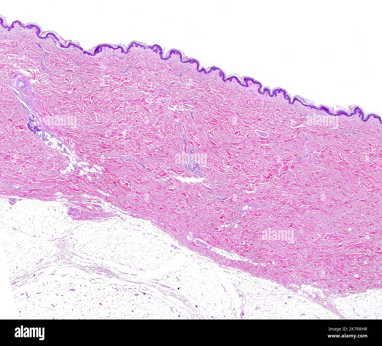 Light micrograph of thin skin showing from top to bottom, the epidermis ...
