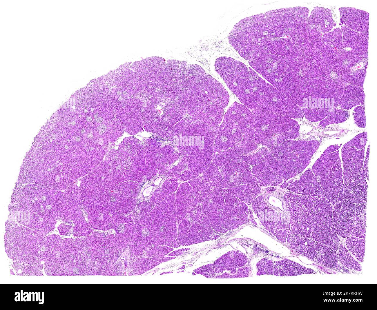 Light micrograph of a section through the human pancreas in the head ...