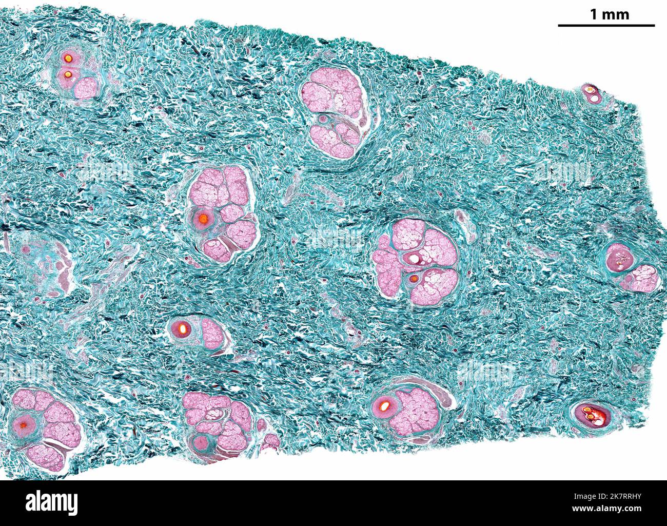 Light micrograph showing the dermis of the thin skin. Among the ...