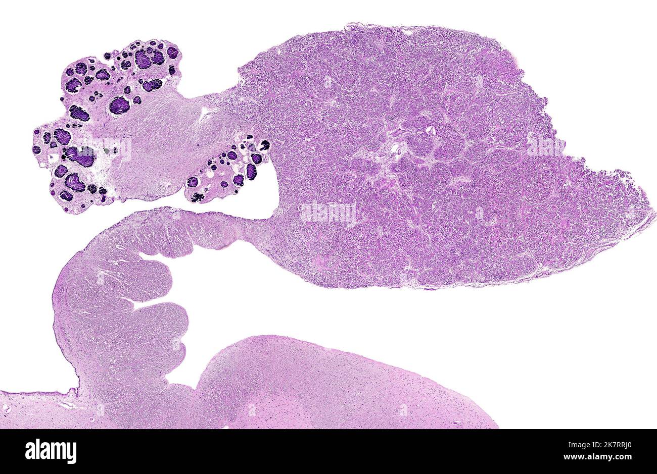 Light micrograph showing a sagittal section of a human pineal gland ...