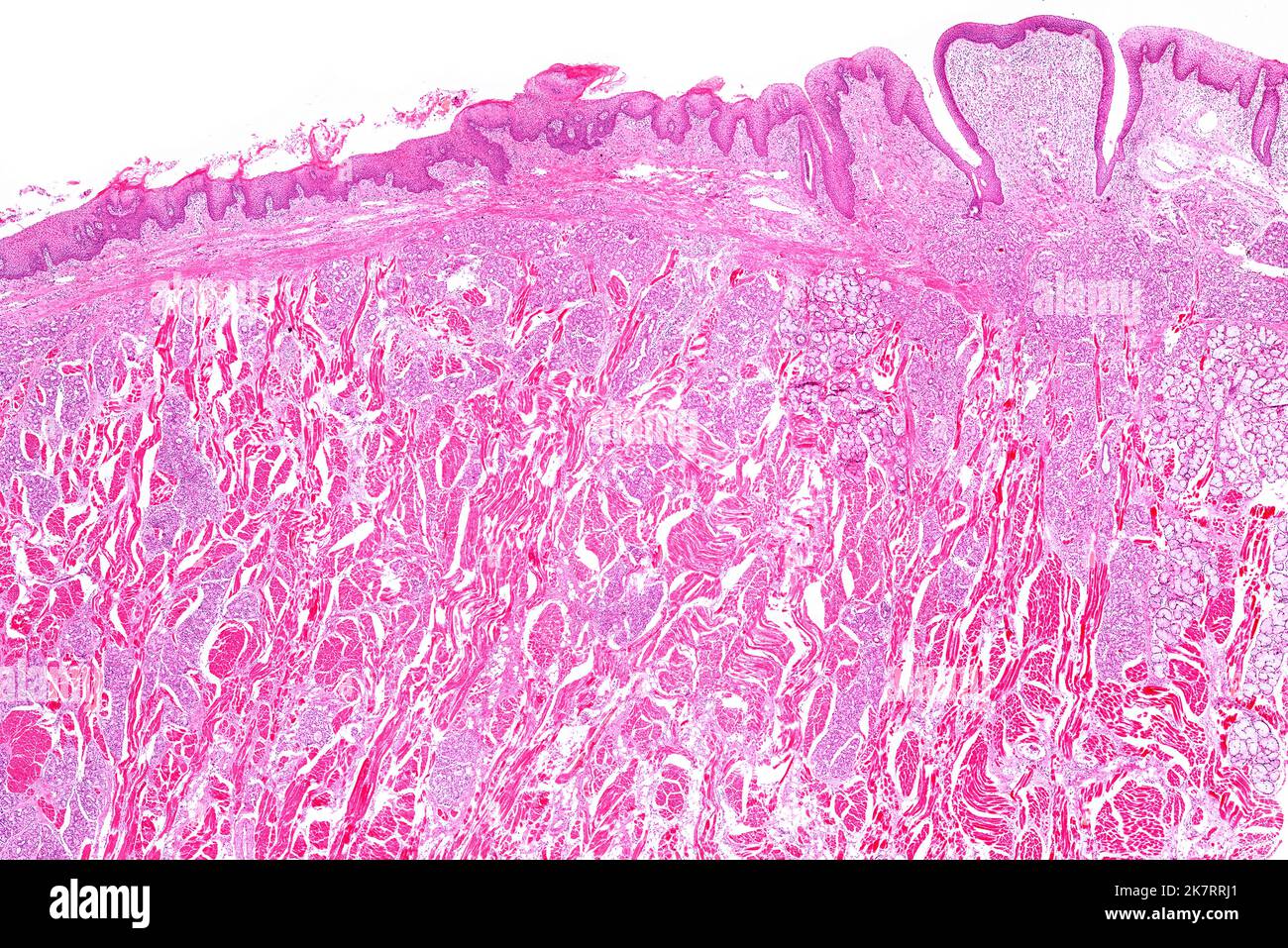 Light micrograph showing a circumvallate, or vallate, papillae (right ...
