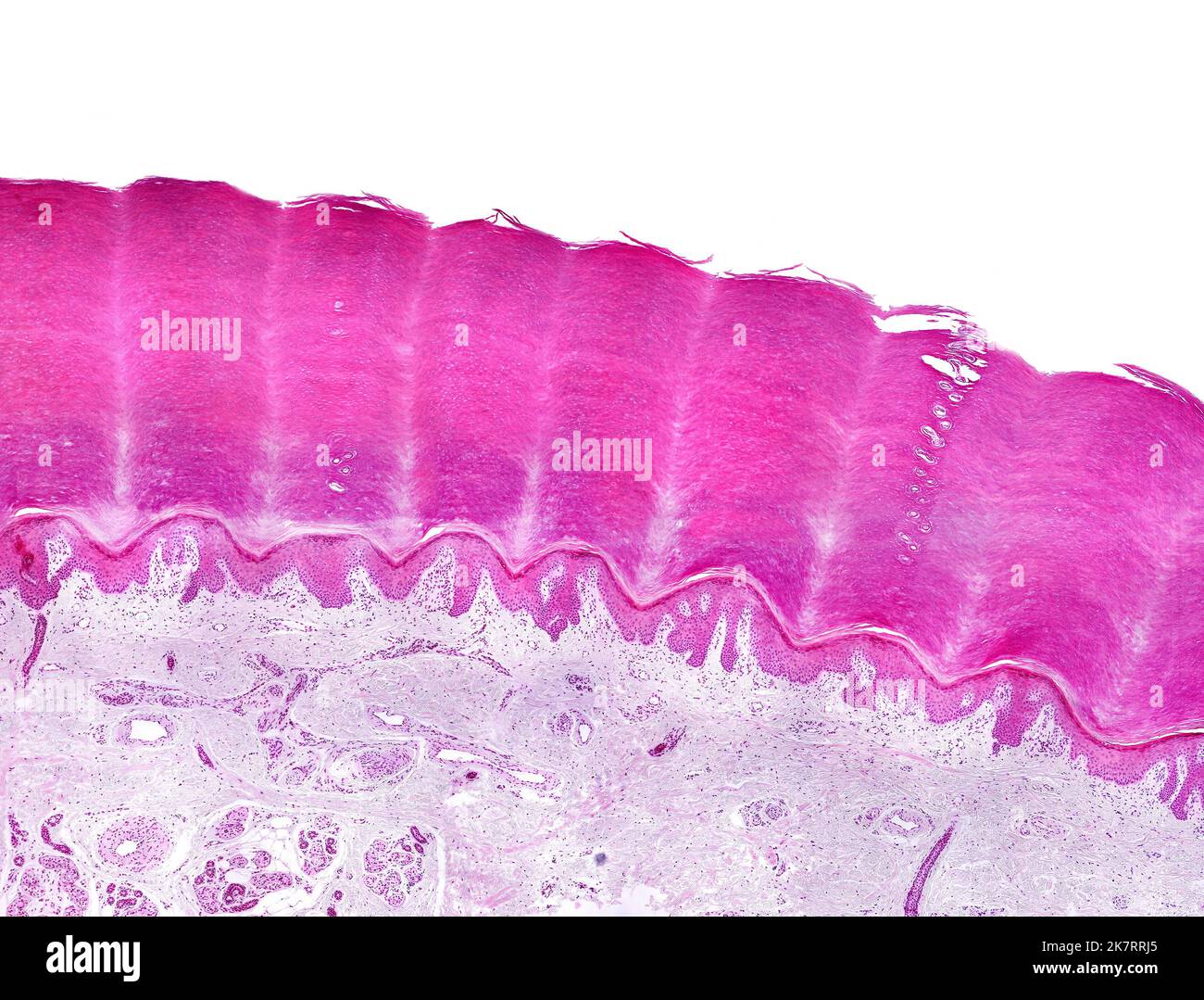 Light micrograph of human glabrous skin. At top is the epidermis, a ...
