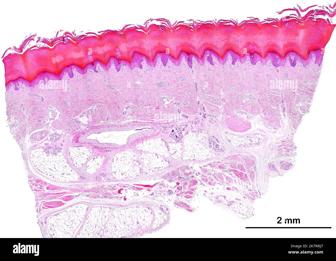 Light micrograph of human glabrous skin. From top, the epidermis, a ...