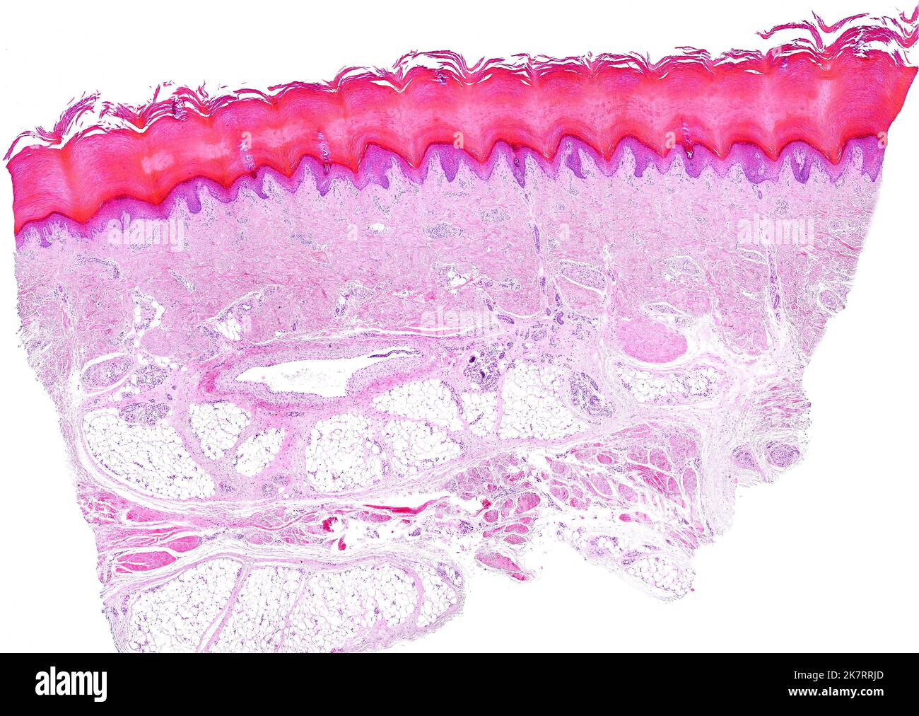 Light micrograph of human glabrous skin. From top, the epidermis, a ...
