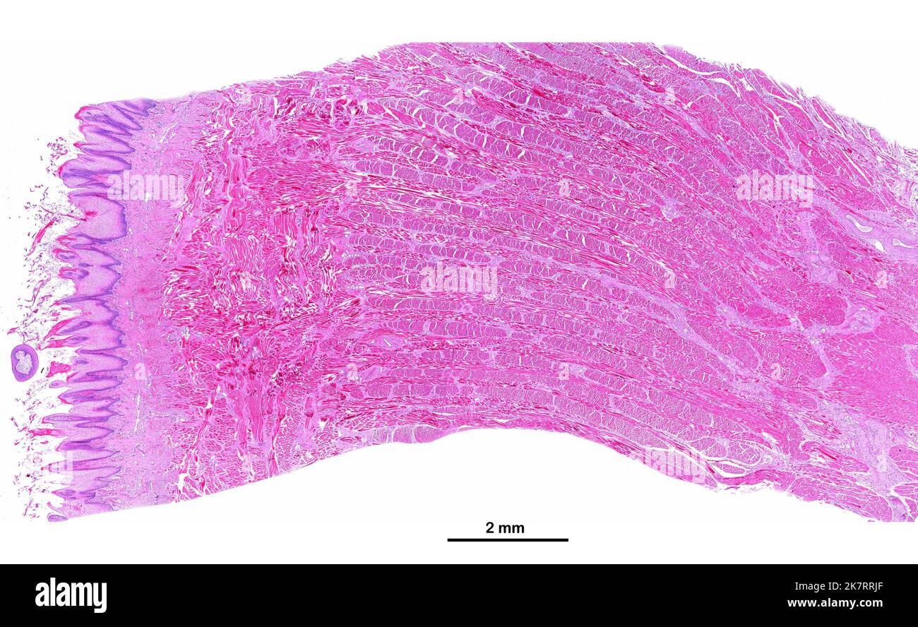 Light micrograph of the upper surface of a human tongue showing, from ...