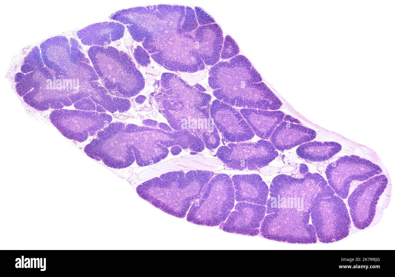 Light micrograph of a human thymus gland stained with haematoxylin and ...