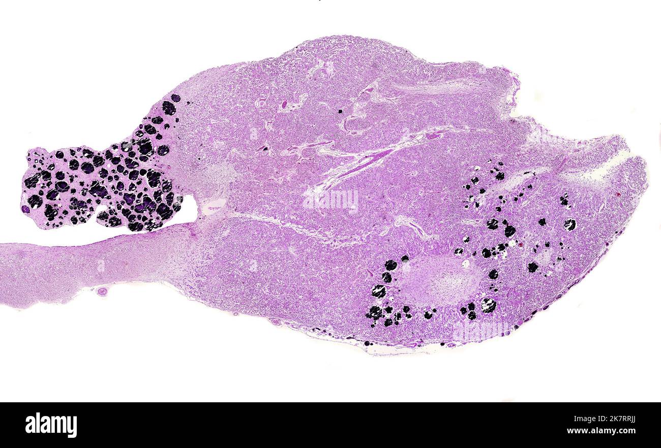 Light micrograph showing a sagittal section of a human pineal gland ...