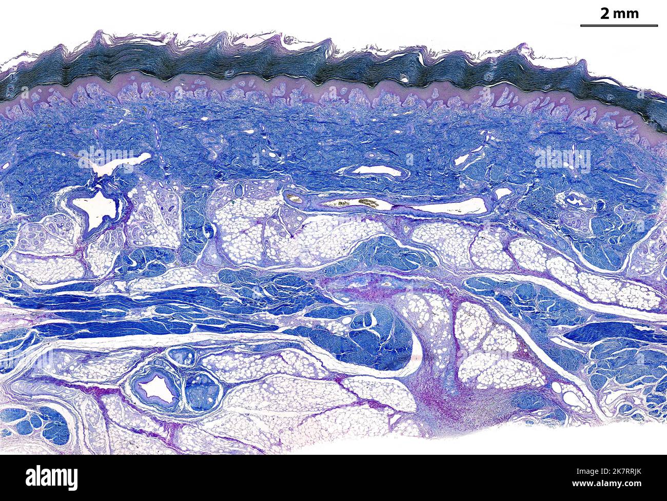 Light micrograph of human thick skin stained with the Cajal-Gallego ...