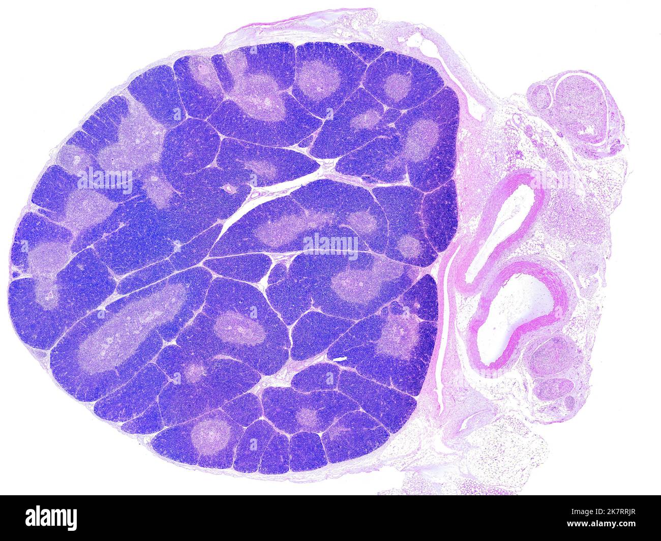 Light micrograph showing a young thymus. The organization into lobules ...