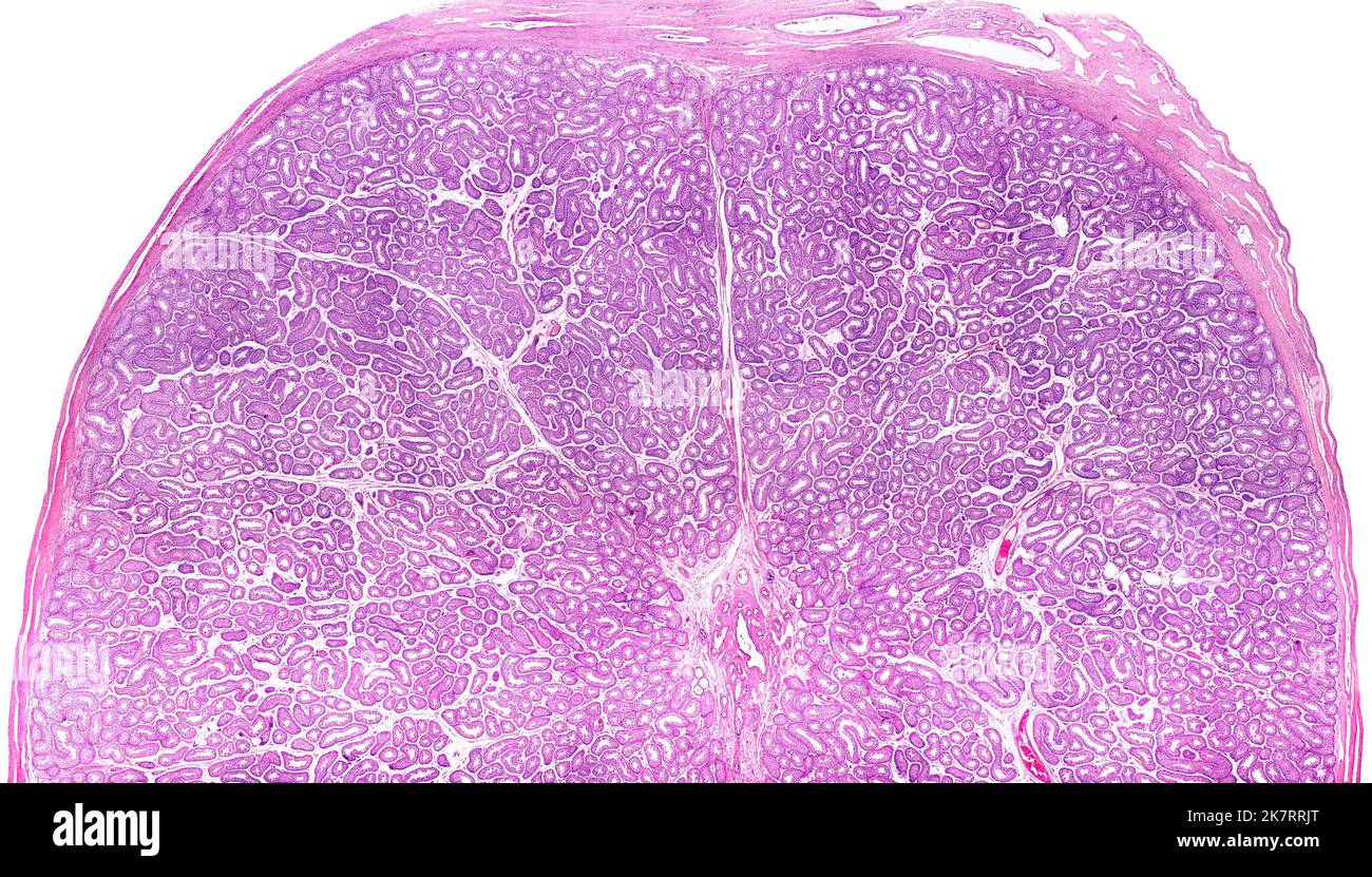 Light micrograph of a human testicle cross-sectioned. Inside the ...