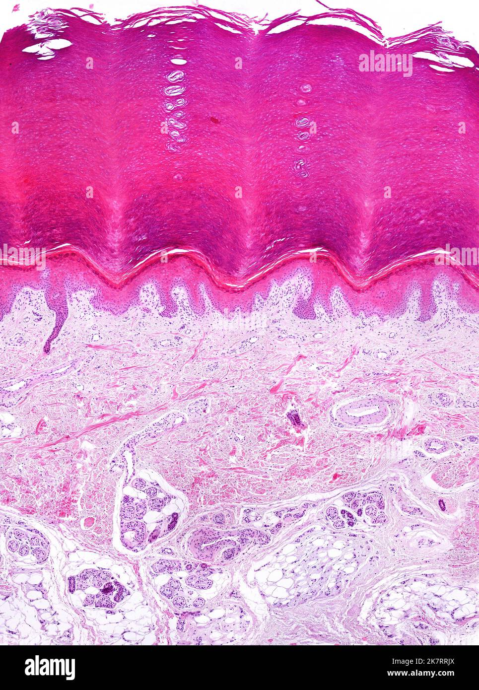 Keratinized Skin Creating Flawless Skin