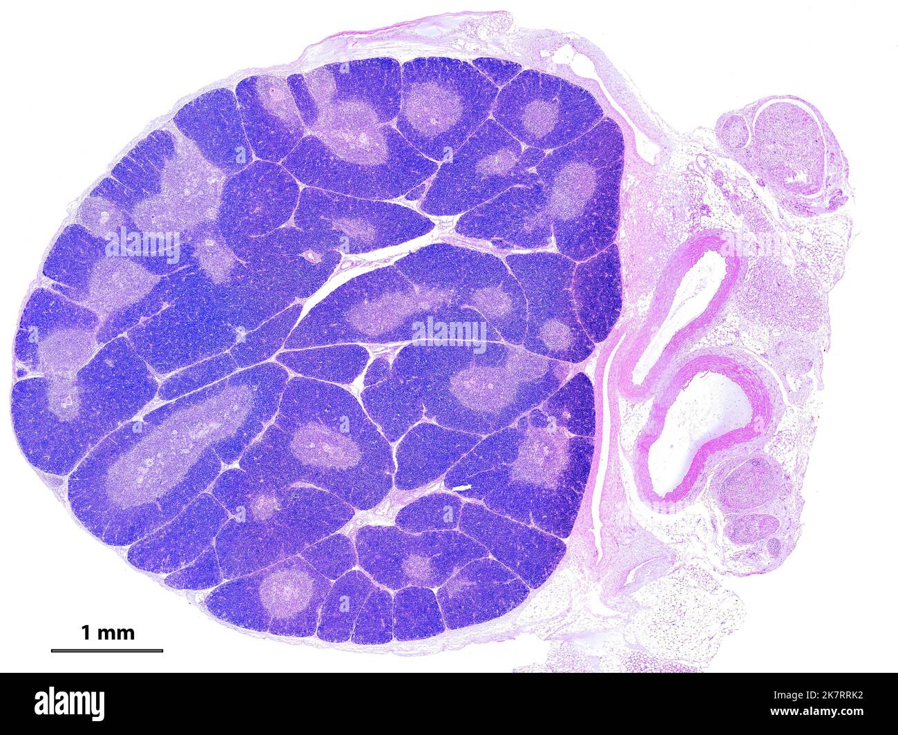 Light micrograph showing a young thymus. The organization into lobules ...