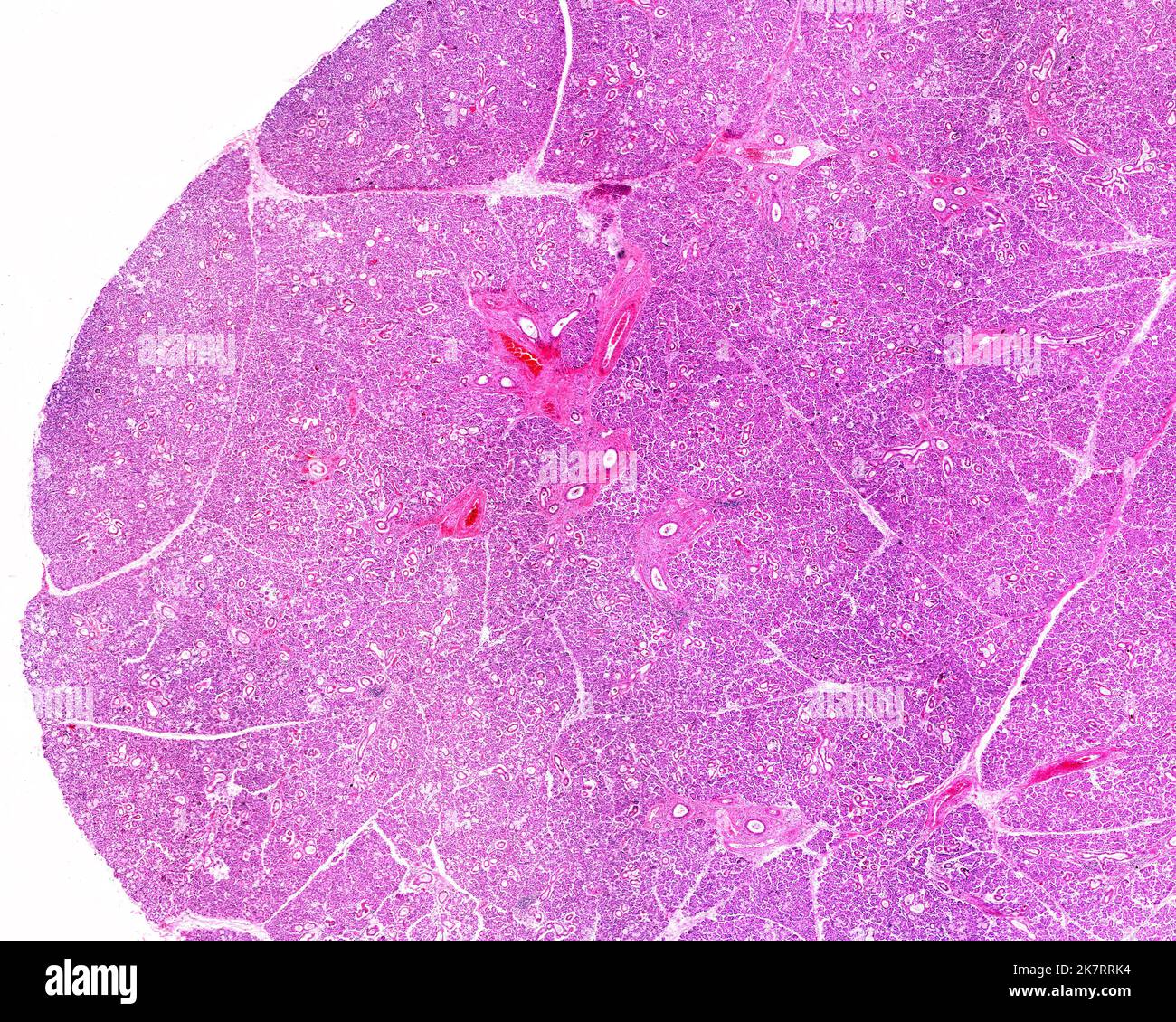 Light micrograph of a human submandibular gland, stained with ...