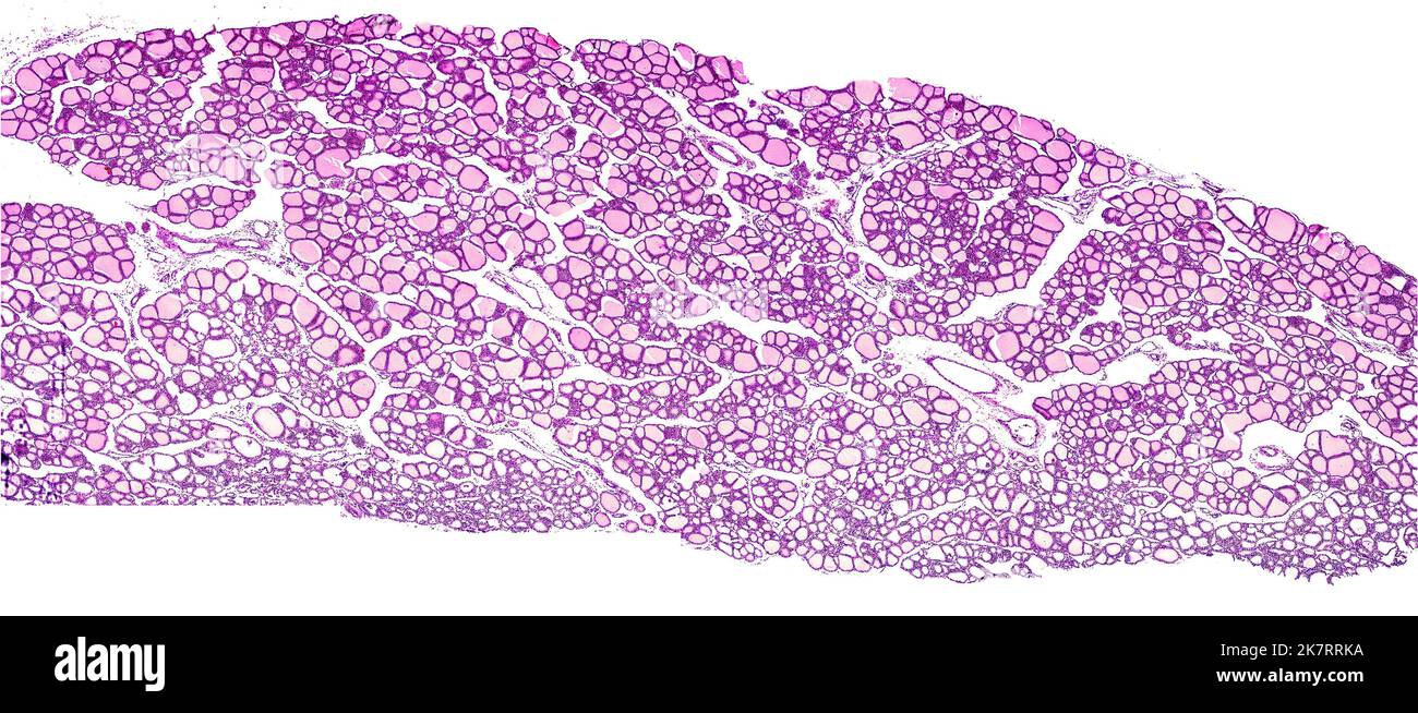 Light micrograph showing a human thyroid. The thyroid parenchyma is ...