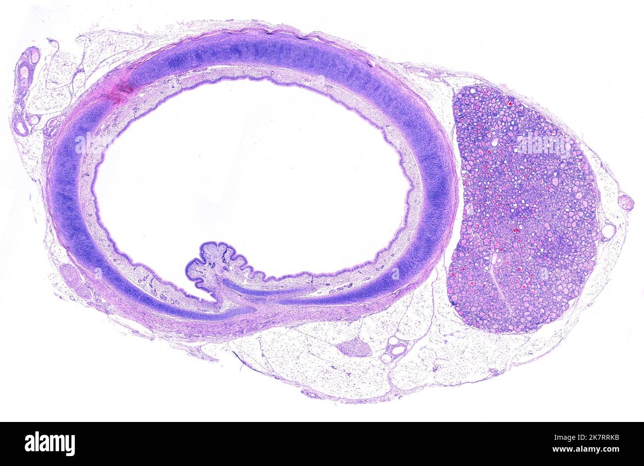 Light micrograph of a cross-section of the trachea, showing C-shaped ...
