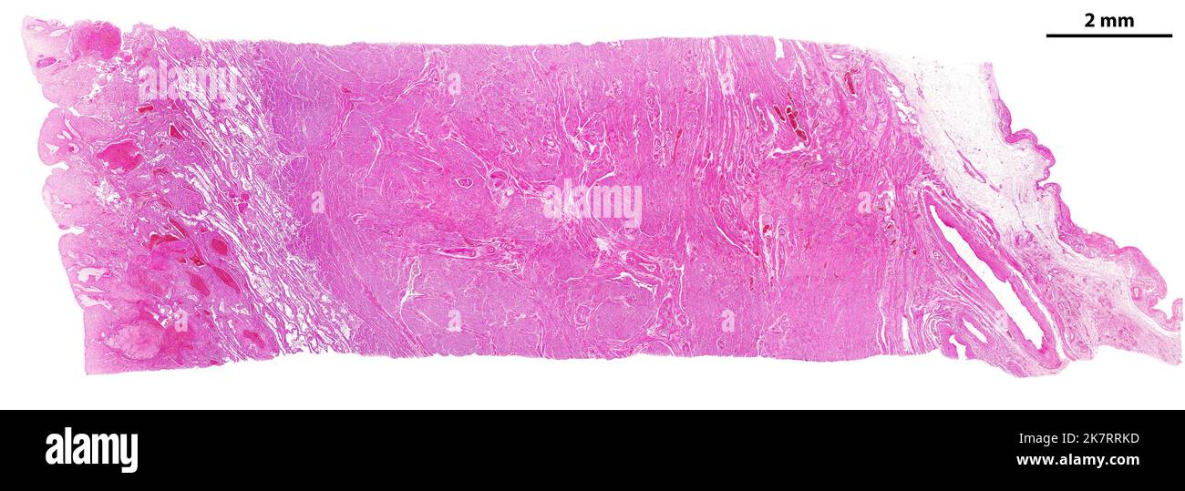 Light micrograph of the whole wall of a human pregnant uterus. At left ...