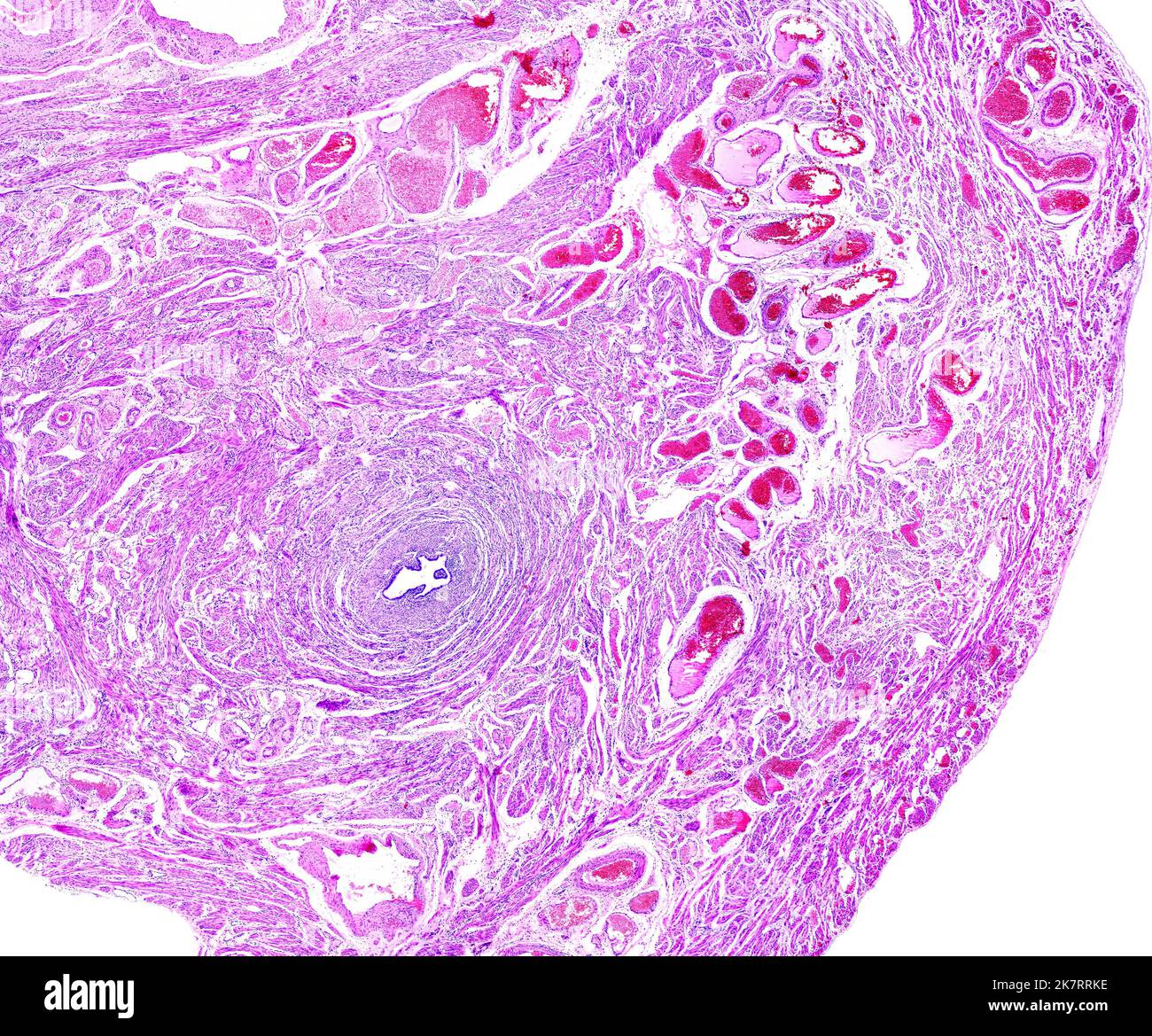Light micrograph showing the intramural region of a human fallopian ...
