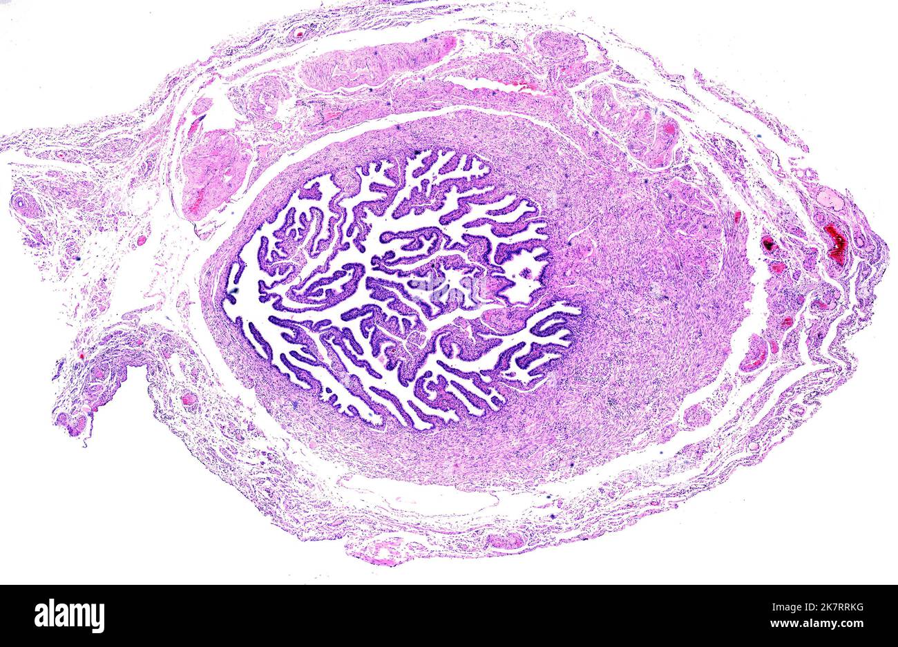 Light micrograph of a cross-section of a human fallopian tube. The ...