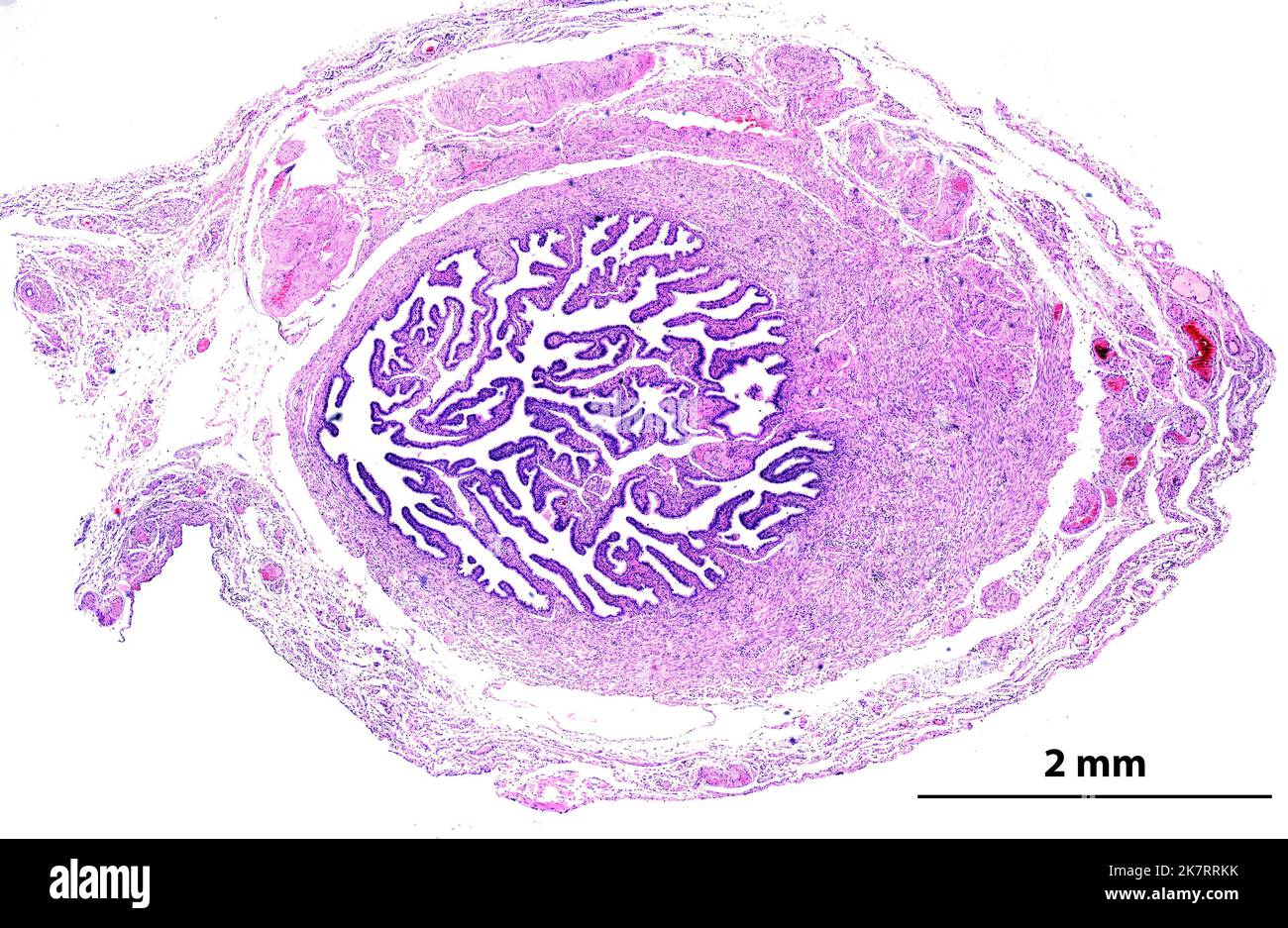 Light micrograph of a cross-section of a human fallopian tube. The ...