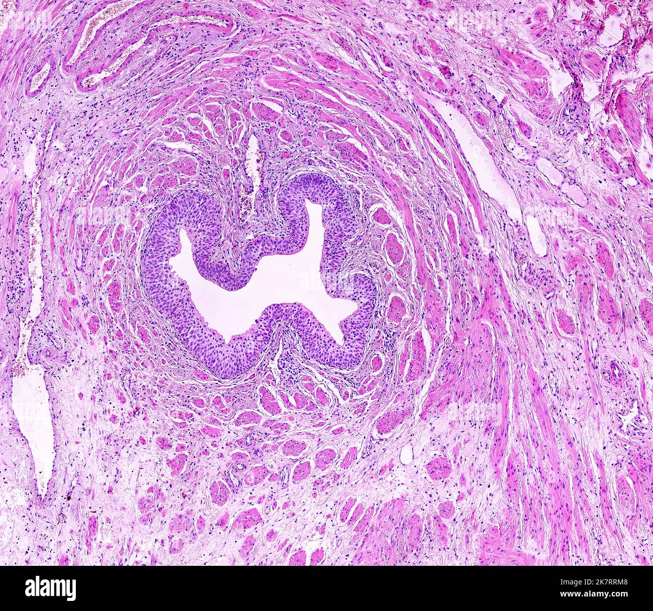 Transitional Epithelium Ureter