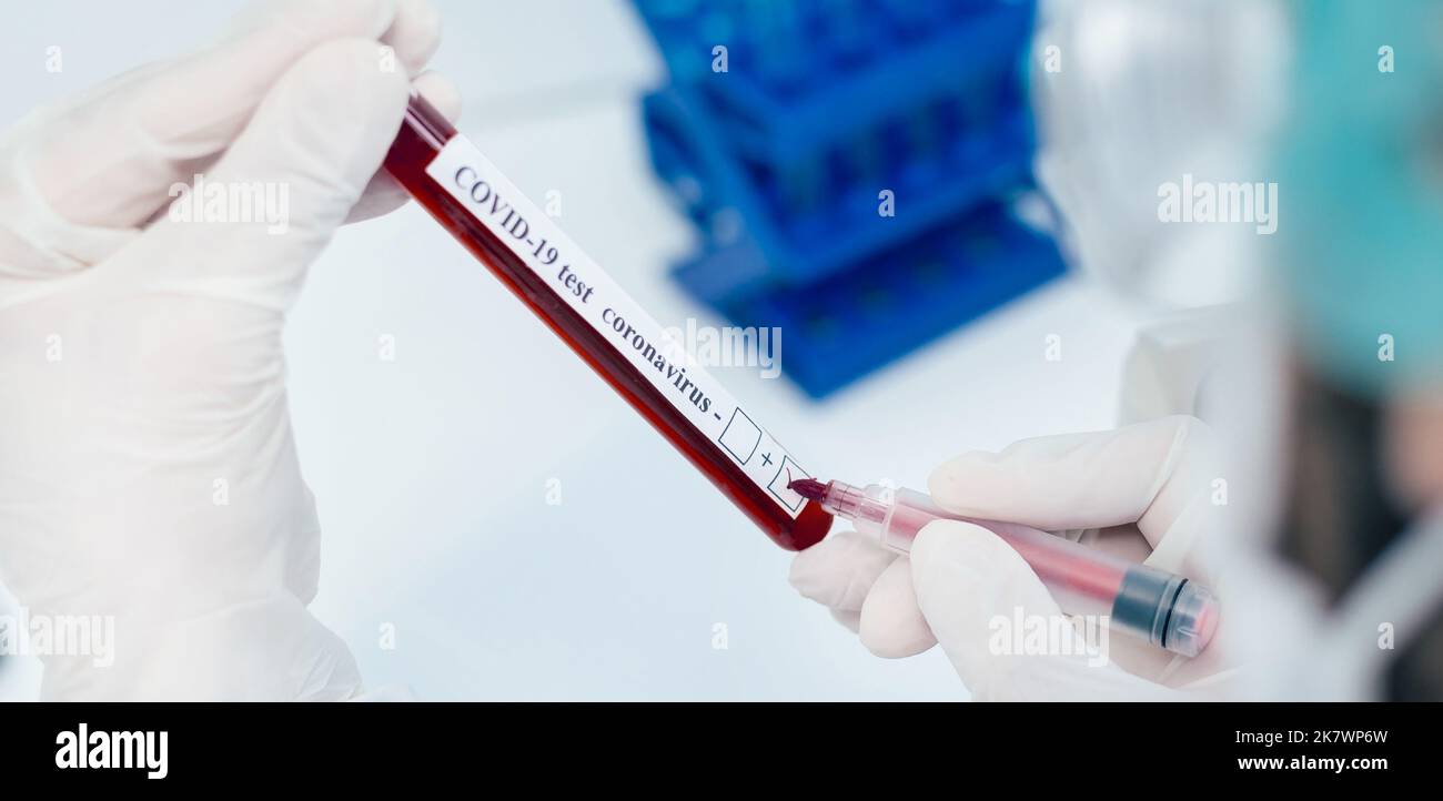 close up. scientist puts a mark on the tube with the test Stock Photo ...