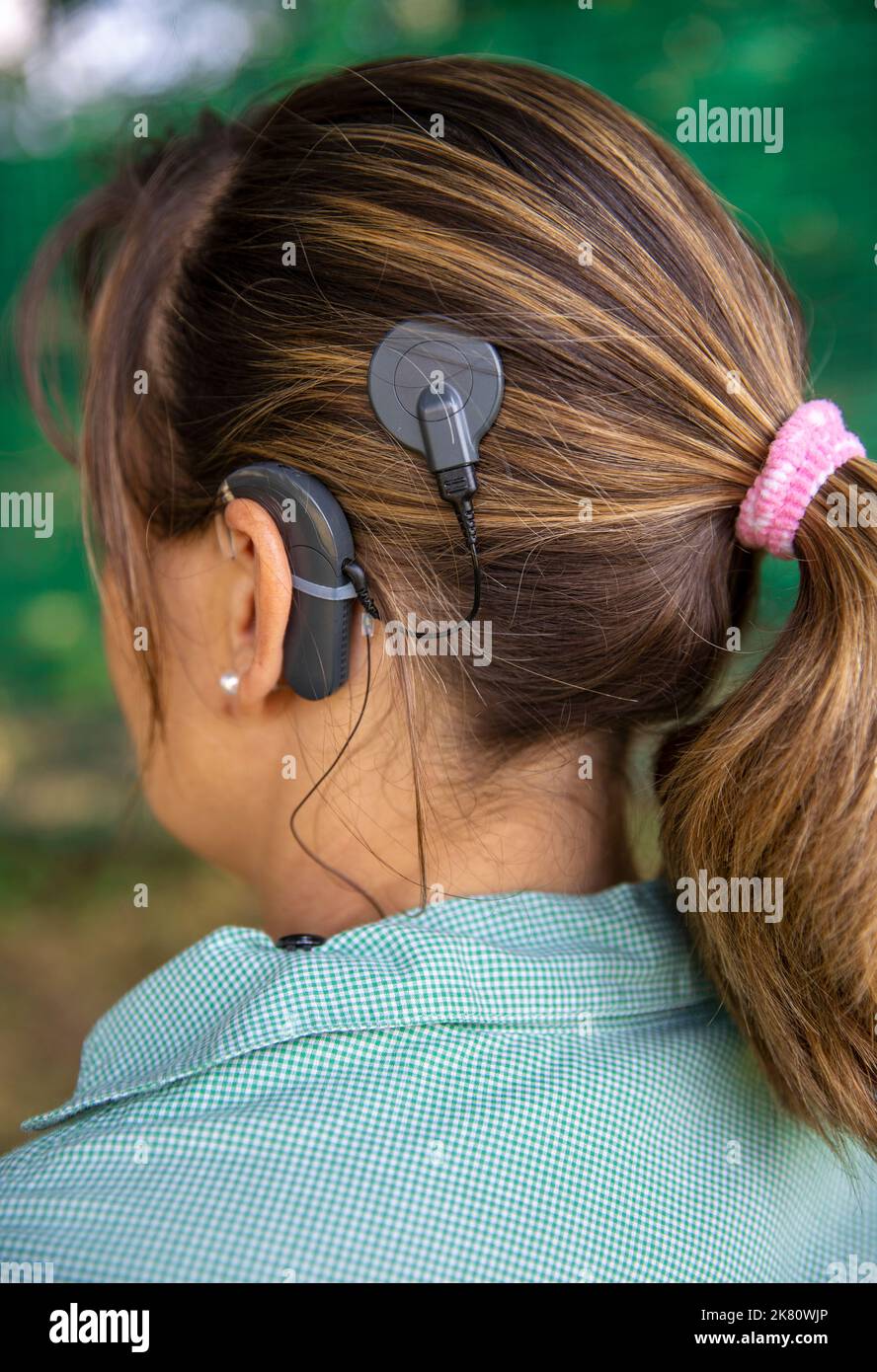 Woman head with cochleral implant hearing aid Stock Photo - Alamy