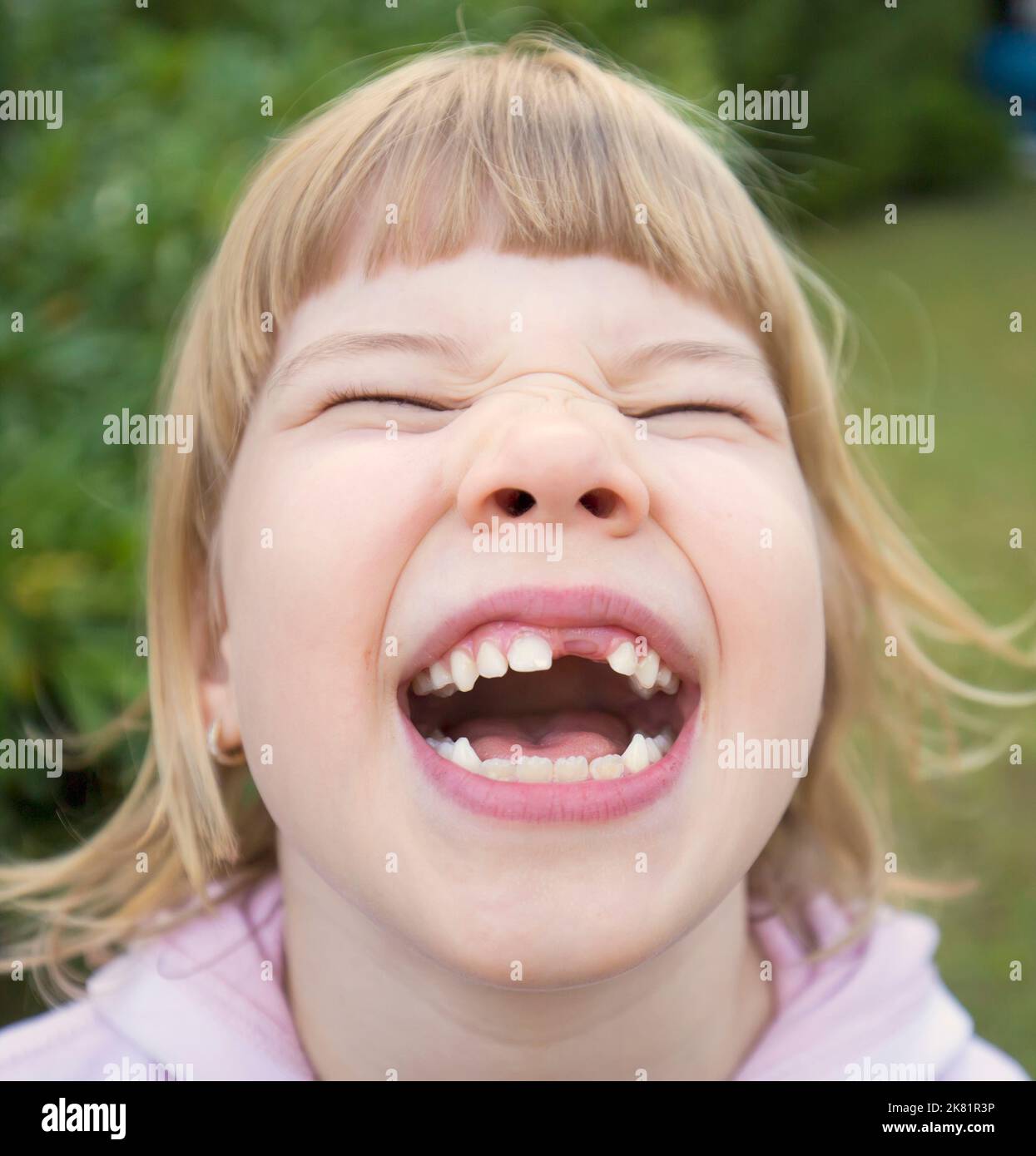 Cute young child make grimace with missing teeth Stock Photo - Alamy