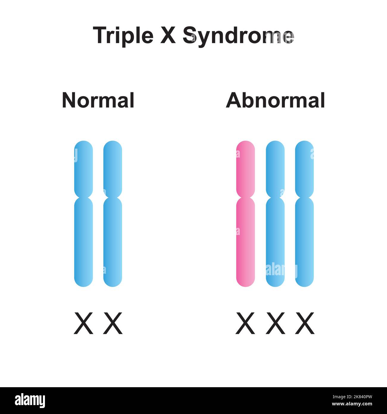 Scientific Designing of Triple X Syndrome (Trisomy X). Colorful Symbols ... Scientific Designing of Triple X Syndrome (Trisomy X). Colorful Symbols ...