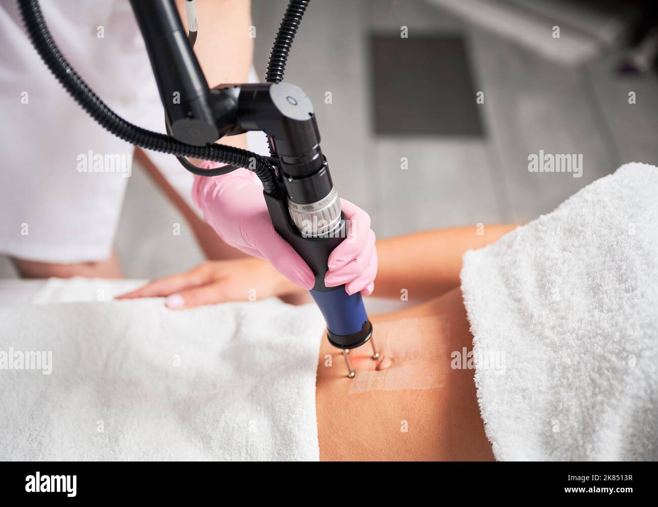 Close-up view of skin abdomen immediately after treatment with carbon ...