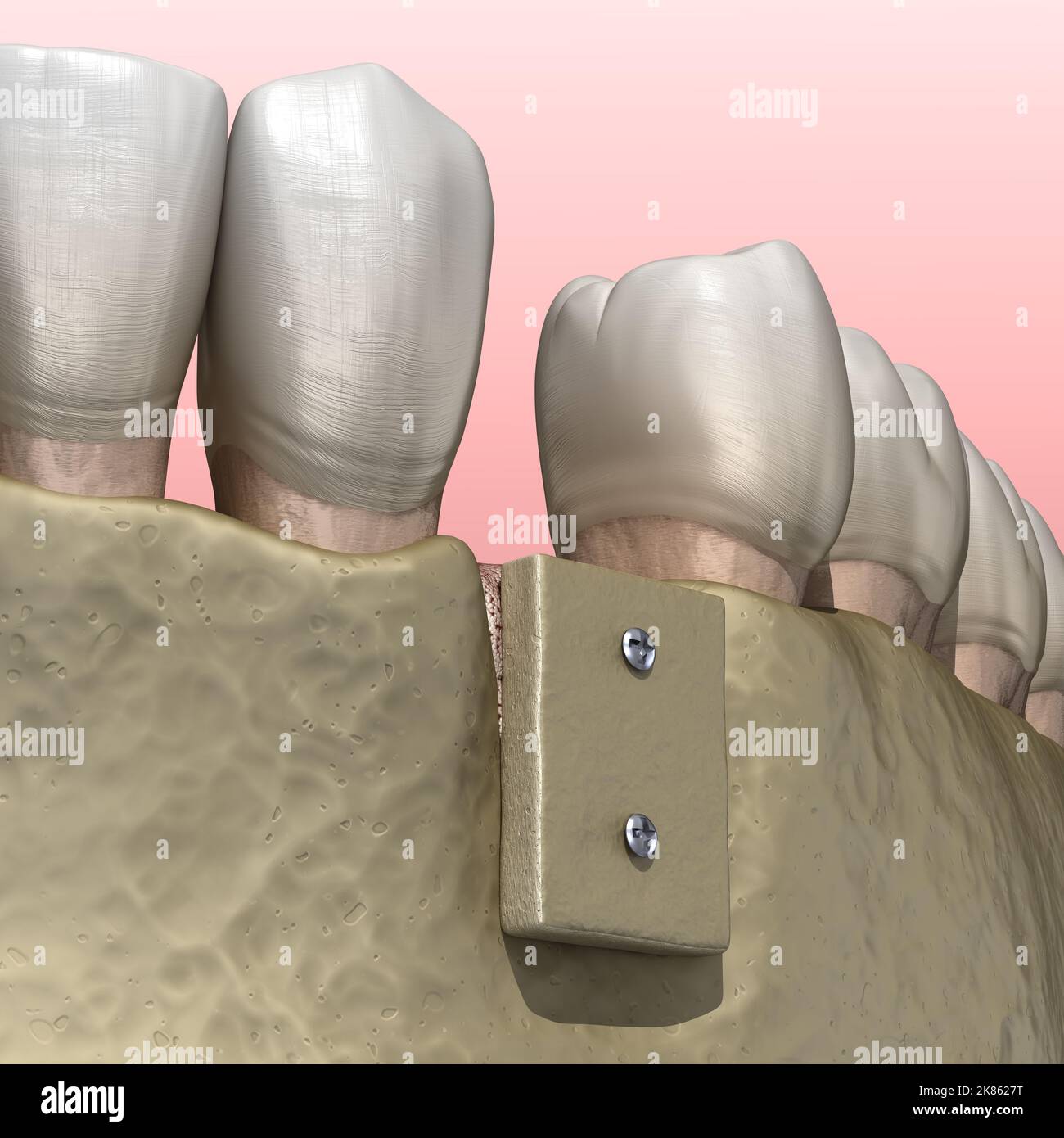 Adding gum hi-res stock photography and images - Alamy