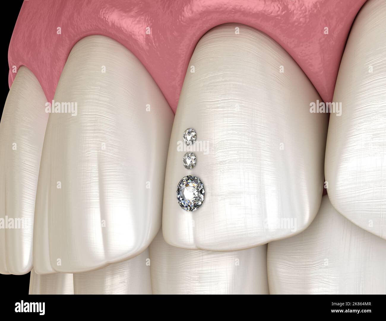 Tooth piercing by diamond, 3D illustration concept Stock Photo - Alamy
