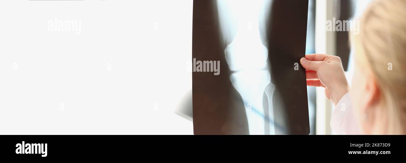 Medical worker analyzing patient leg x ray on monitor in clinic room ...