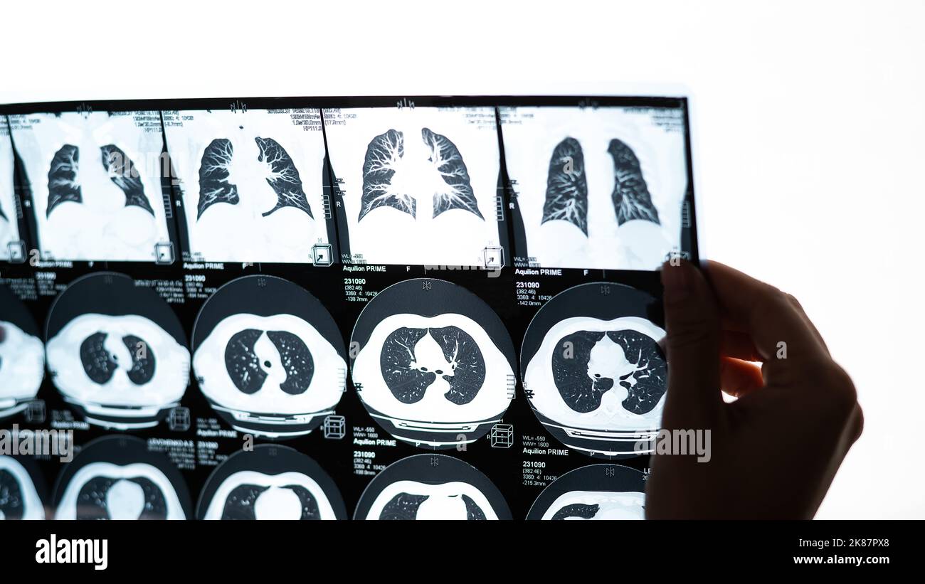 A female doctor examines an MRI scan of the internal organs. Abdomen ...