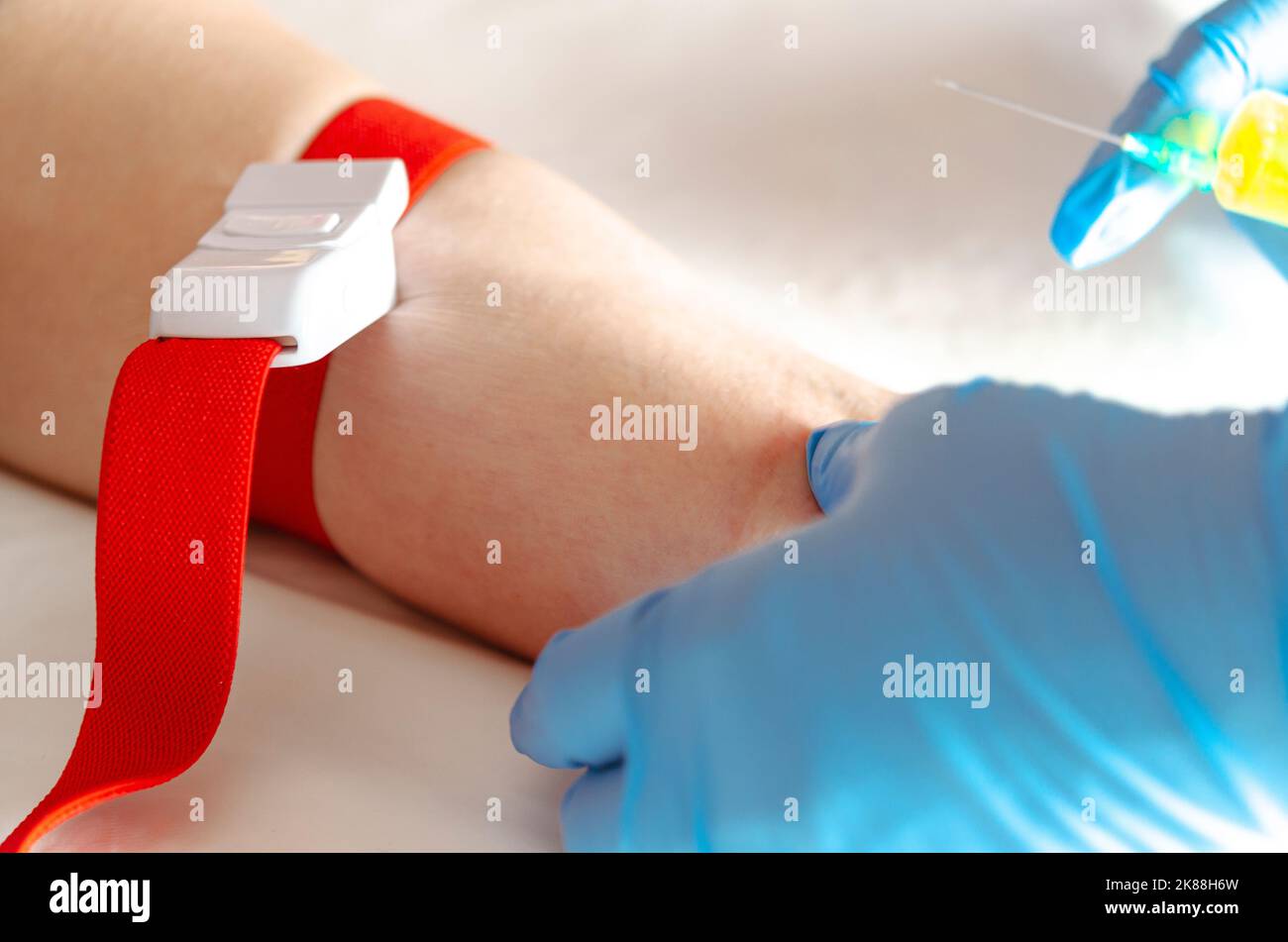 Woman's vein ready for intravenous injection during pandemic Stock ...