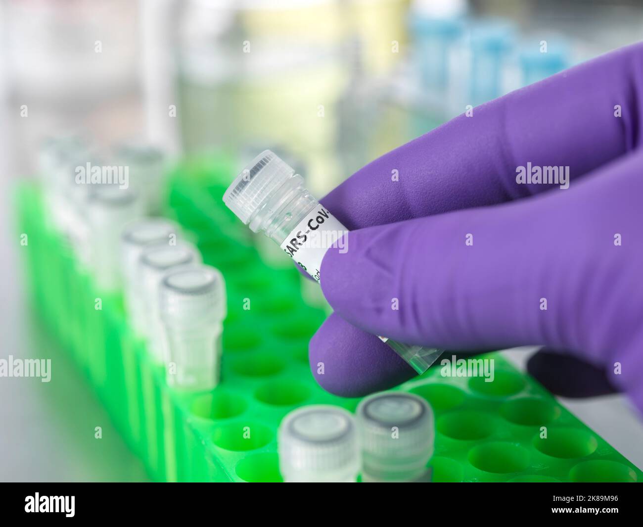 Sars virus molecule hi-res stock photography and images - Alamy