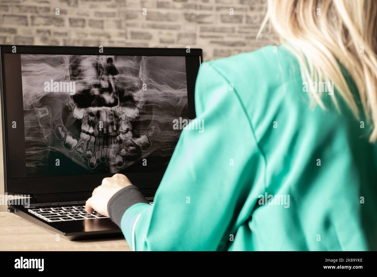 panoramic X-ray of children's teeth of two jaws, orthopantomogram of ...