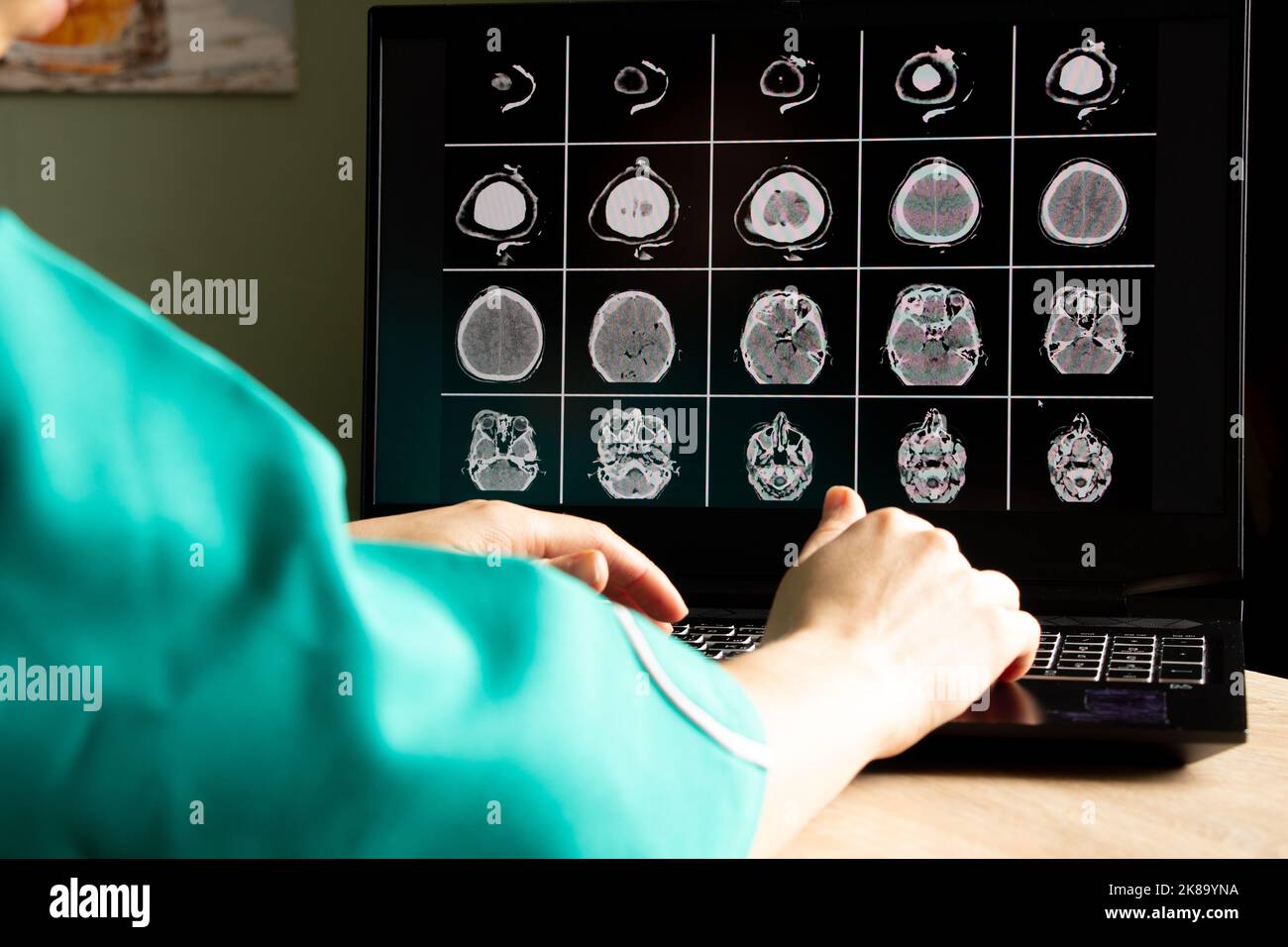 Computed tomography hi-res stock photography and images - Alamy