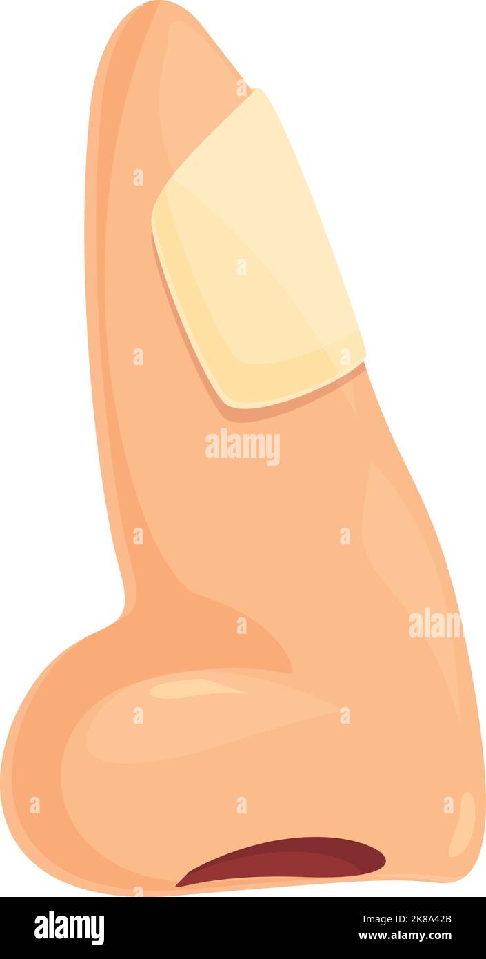 Closed rhinoplasty icon cartoon vector. Nose surgery. Side operation ...